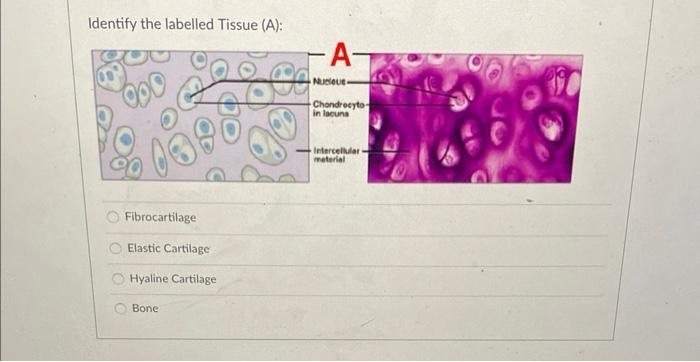 Solved Identify the labelled epithelium (A): Simple cuboidal | Chegg.com