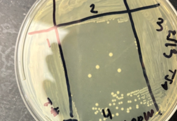Solved Find the: Colony Forming Units (CFUs) ﻿on agar plate | Chegg.com
