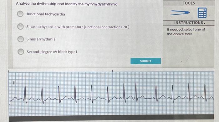 Solved Analyze the rhythm strip and identify the | Chegg.com