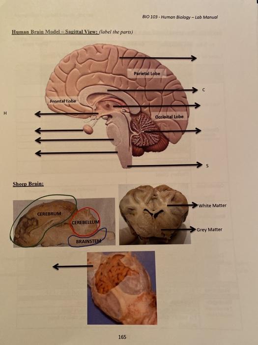 Labeled Sagittal Brain Model