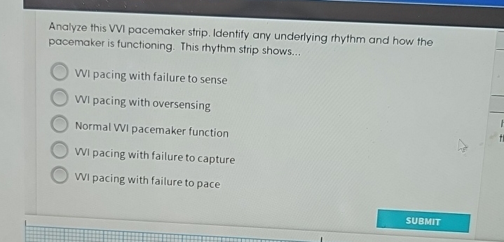 Solved Analyze this VVI pacemaker strip. Identify any | Chegg.com