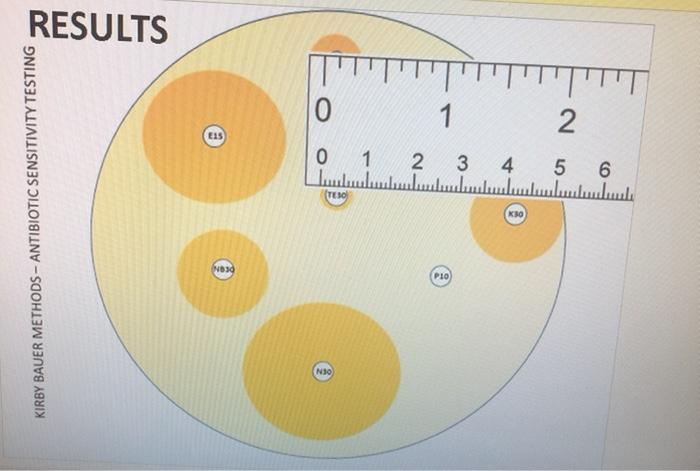 Solved Results: Table 1. Zone Size Interpretation Chart and | Chegg.com