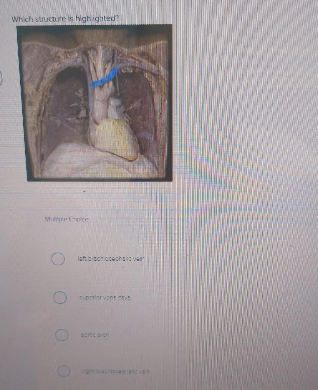 Solved Which structure is highlighted? Multiple Cholce eft | Chegg.com