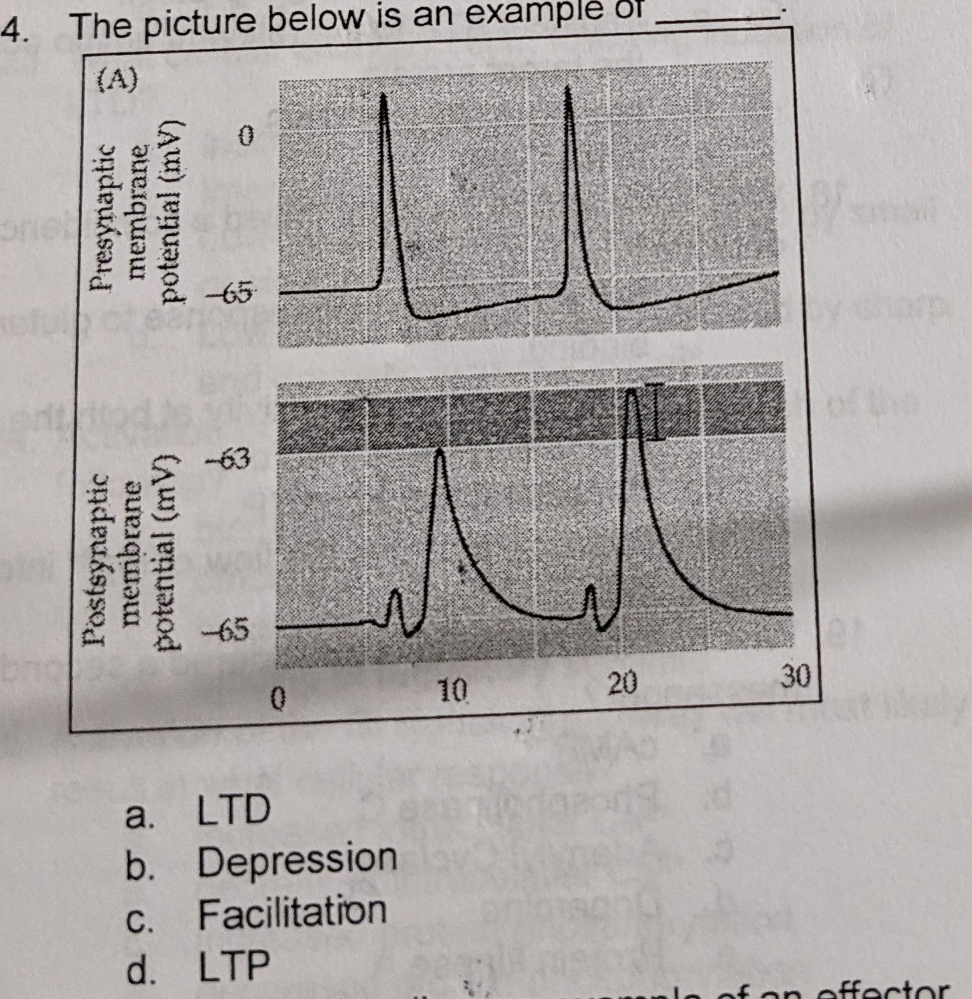 Solved The picture below is an example ofa. ﻿LTDb. | Chegg.com