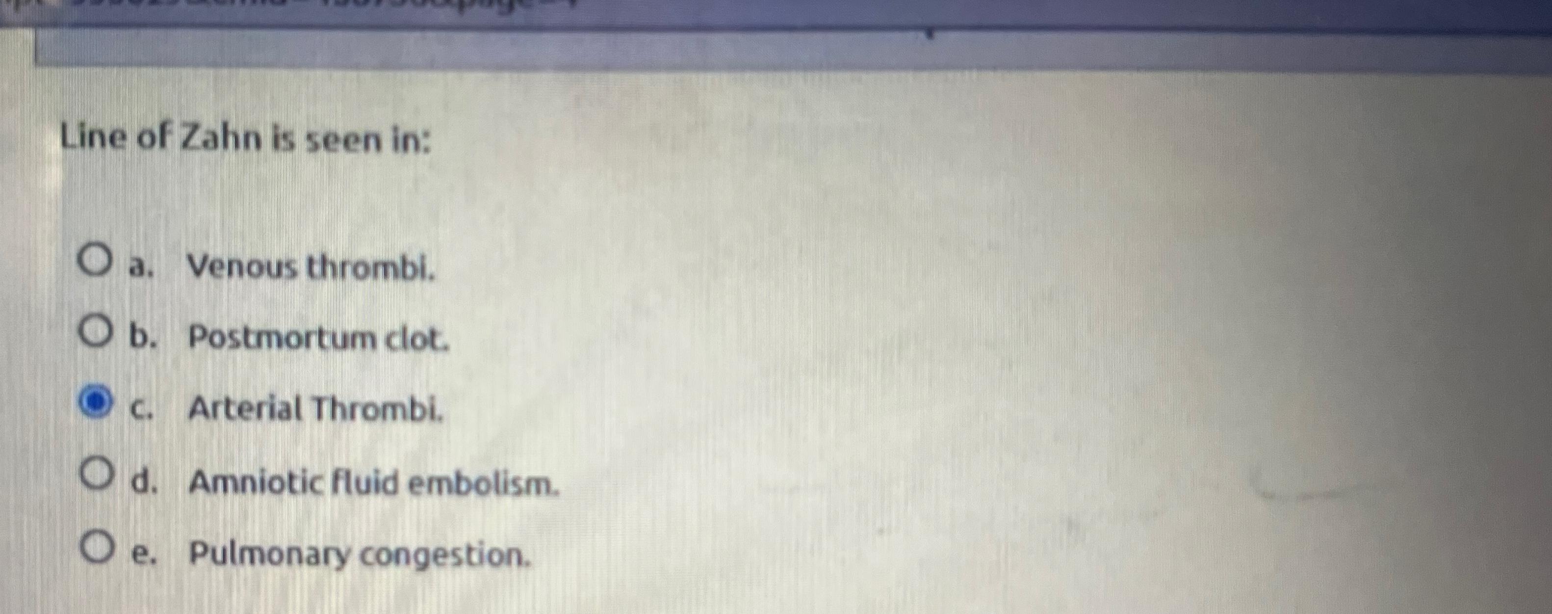 Solved Line of Zahn is seen in:a. ﻿Venous thrombi.b. | Chegg.com