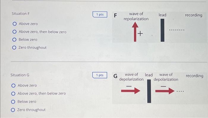 Solved Situation D Above zero Above zero, then below zero | Chegg.com