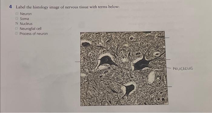 Solved 4 Label the histology image of nervous tissue with | Chegg.com