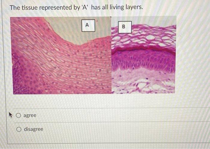 Solved The tissue represented by 'A' has all living layers. | Chegg.com