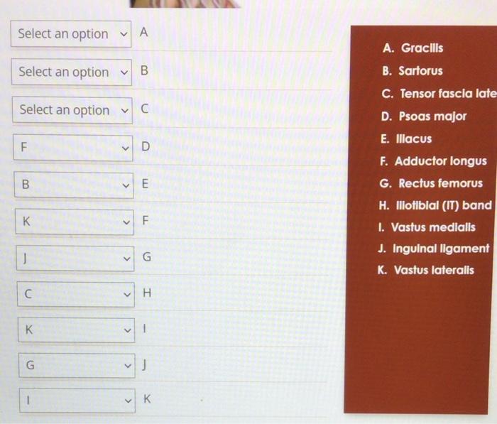 Solved Label the Muscle Structures | Chegg.com