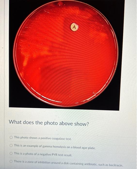 Solved Which one of the following tests yields a pink color | Chegg.com