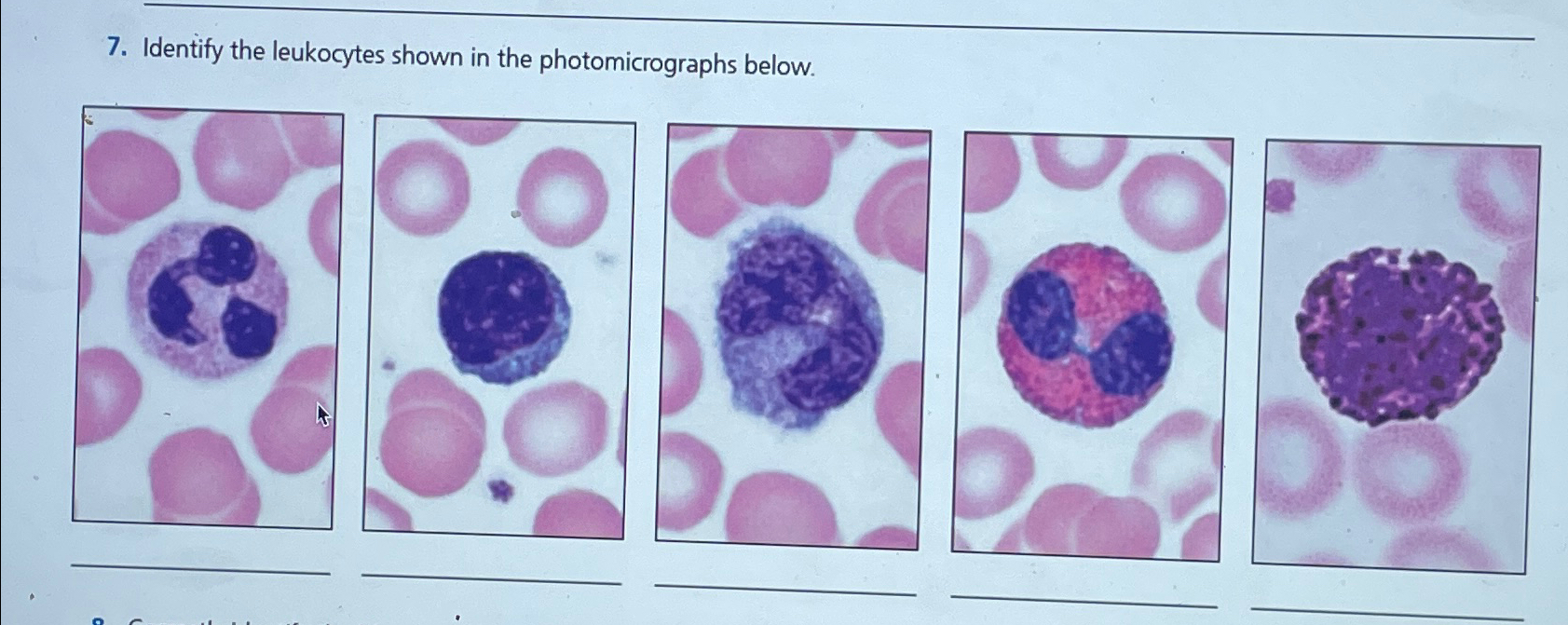 Solved Identify the leukocytes shown in the photomicrographs | Chegg.com