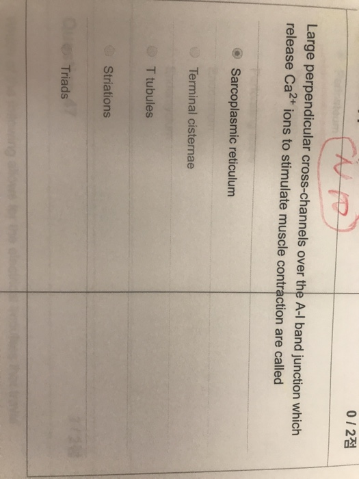 Solved 012 ND Large perpendicular cross-channels over the | Chegg.com