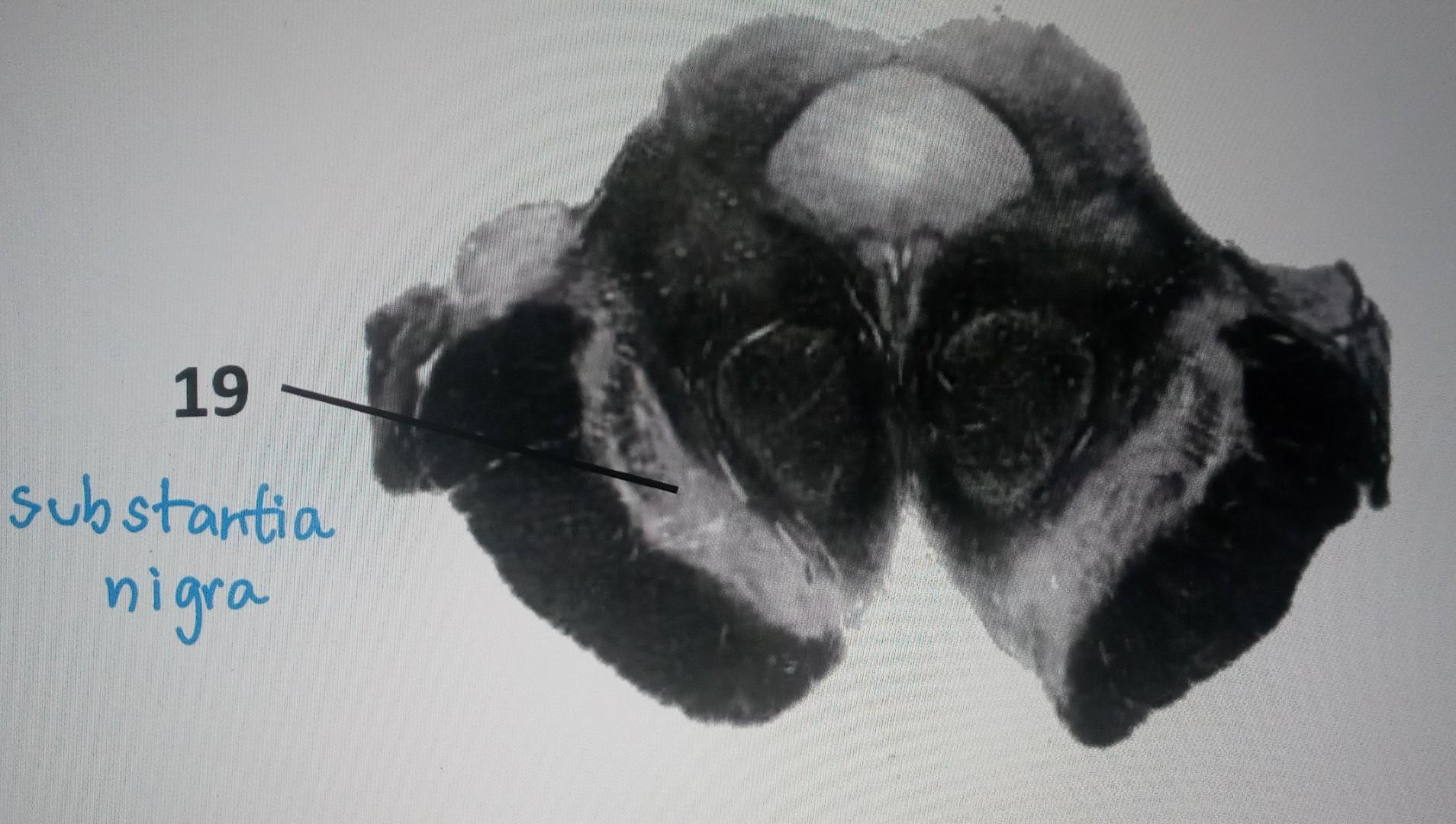 Solved please label ALL the structures seen in the pictures | Chegg.com