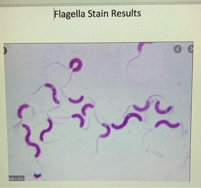 Solved 3-12 Flagella Stain OBSERVATIONS AND INTERPRETATIONS | Chegg.com