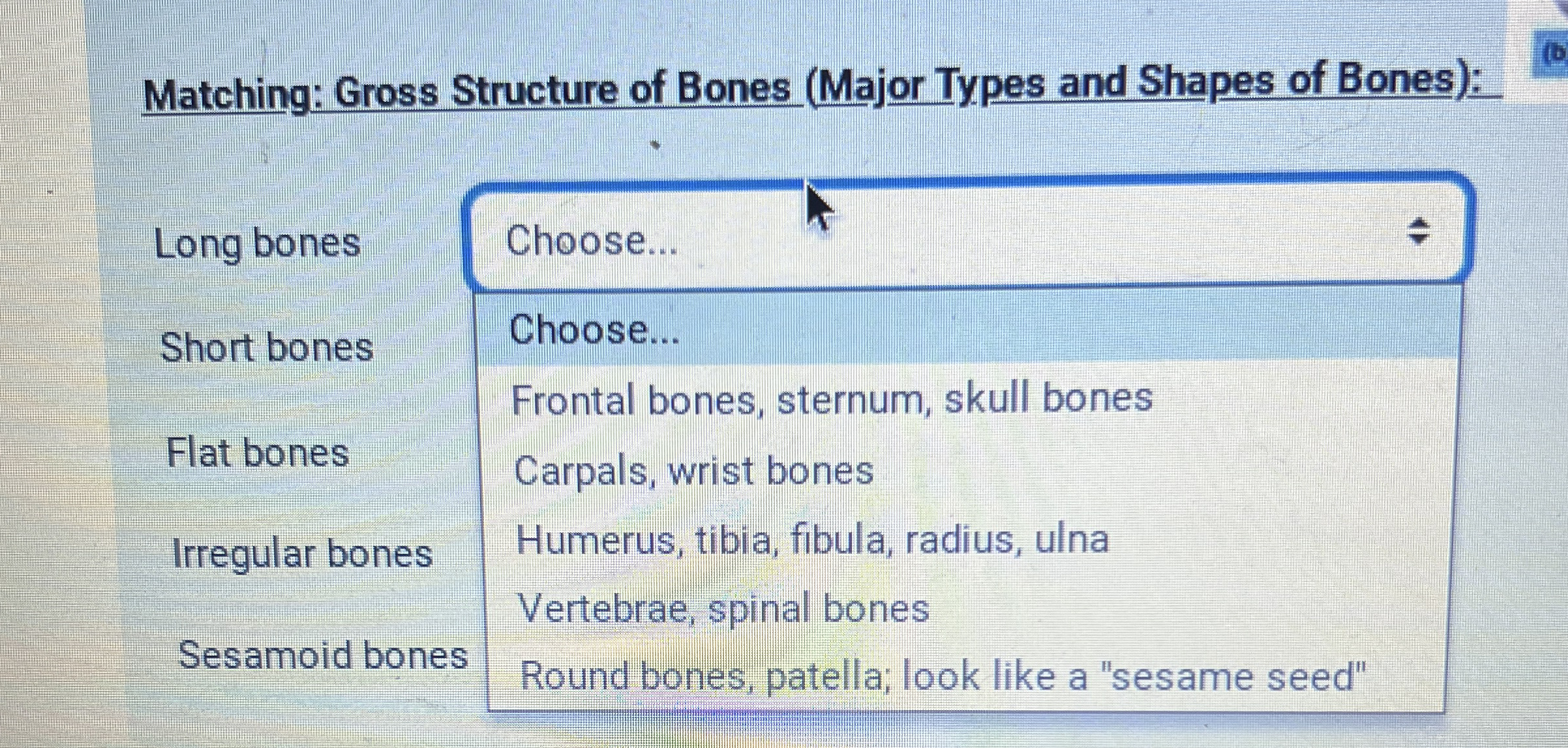 [Solved]: Matching: Gross Structure of Bones (Major Types an