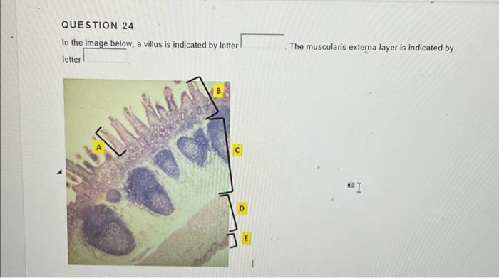 Solved In the image below, a villus is indicated by letter | Chegg.com