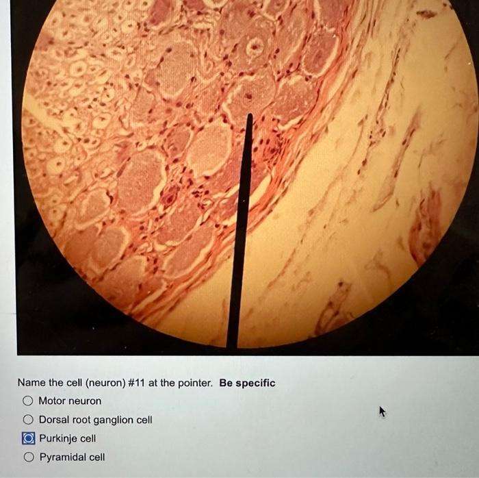 Solved Name the cell (neuron) \#11 at the pointer. Be | Chegg.com