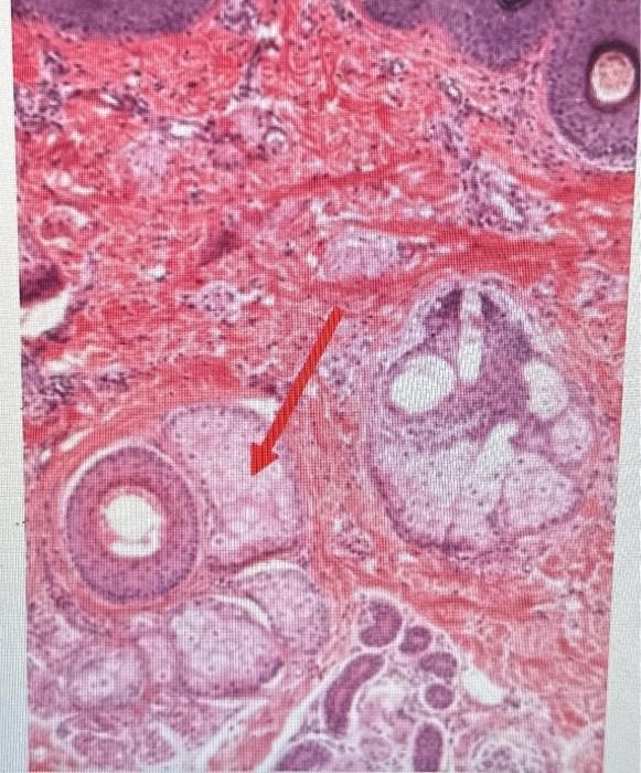 identify the structure the red arrownis pointing at. | Chegg.com