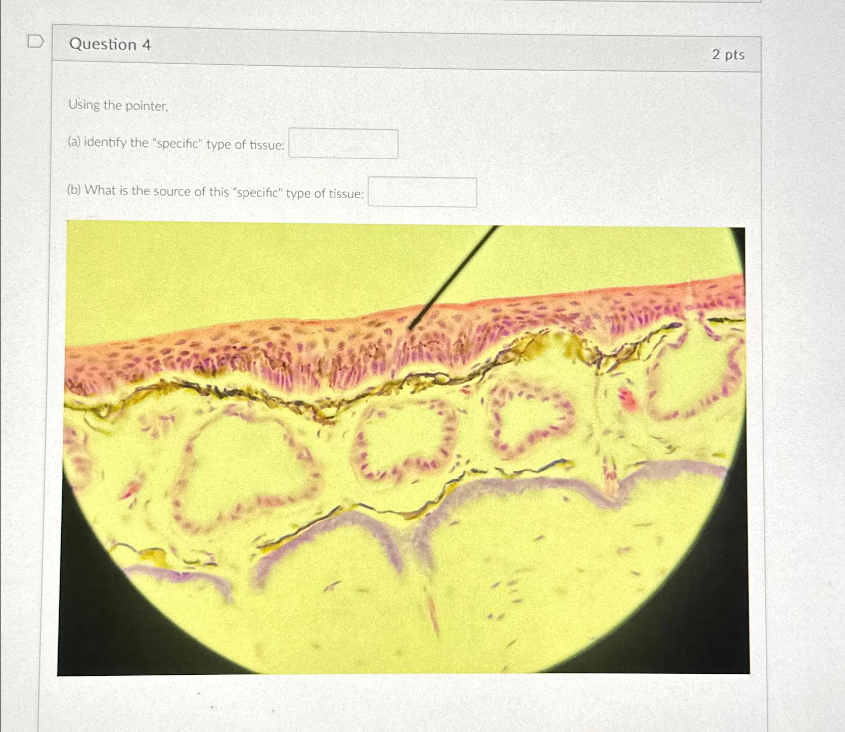 Solved Question 42ptsUsing the pointer,(a) ﻿identify the | Chegg.com