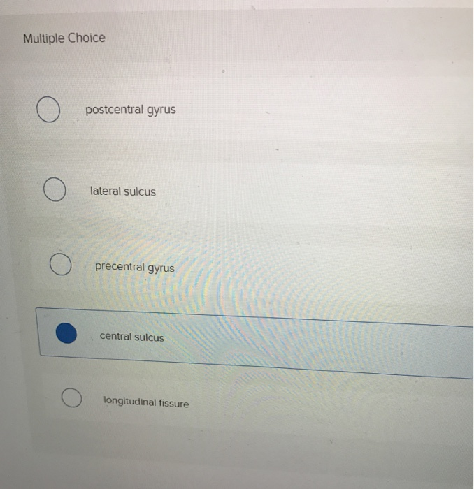 Solved Which structure is highlighted? Multiple Choice O | Chegg.com