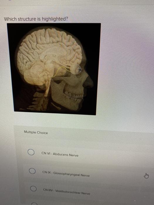 Solved Which structure is highlighted? Multiple Choice CN | Chegg.com