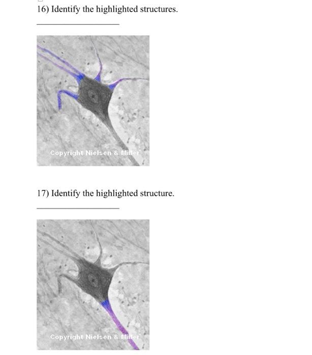 Solved 16) Identify the highlighted structures. 17) Identify | Chegg.com