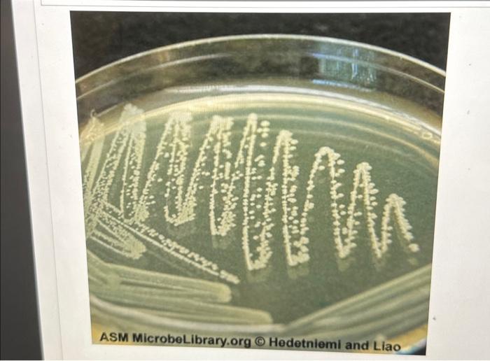 Solved Look at the picture of the plate(s) below and use | Chegg.com