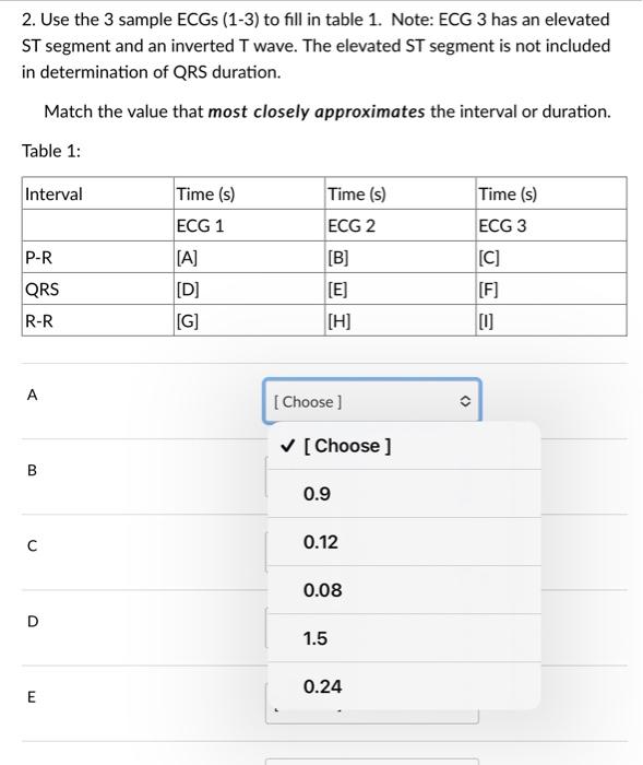 Solved Question 2 4.5 pts Sample ECGS Arrhythmia Tracing | Chegg.com