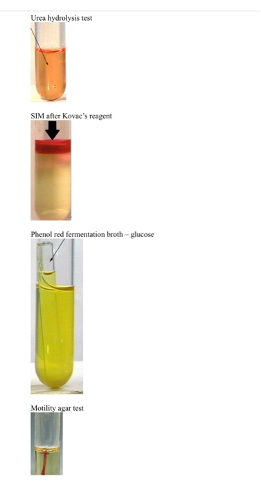 Solved Citrate utilization test Urea hydrolysis test SIM | Chegg.com