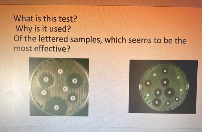 Solved Identify this test. Which tube shows a positive | Chegg.com
