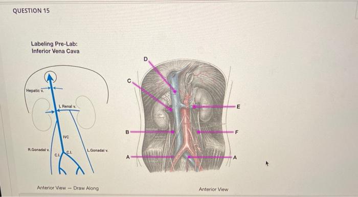 Solved Labeling Pre-Lab: Descending Aorta B C TA ALB E CH | Chegg.com