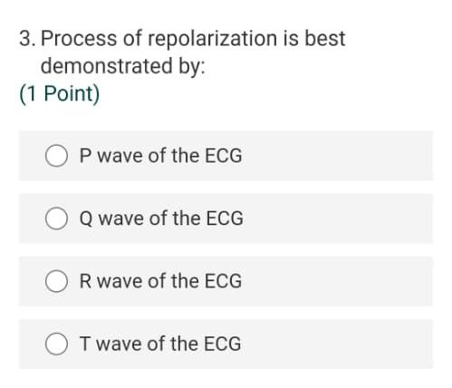 Solved 3. Process of repolarization is best demonstrated by: | Chegg.com