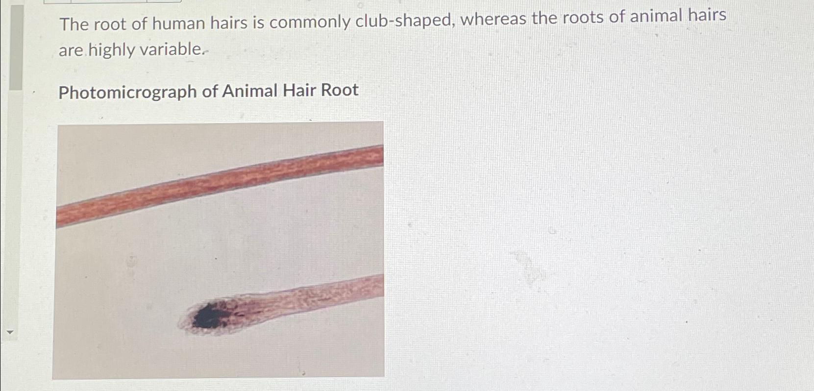 Solved The root of human hairs is commonly club-shaped, | Chegg.com
