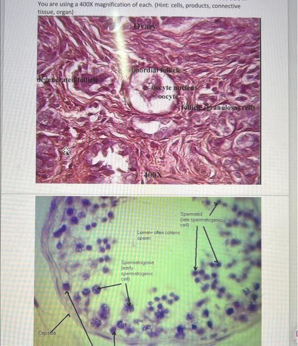 You are using a 400X magnification of each. (Hint: | Chegg.com