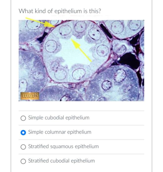 Solved What structure is highlighted in blue? Lumen | Chegg.com