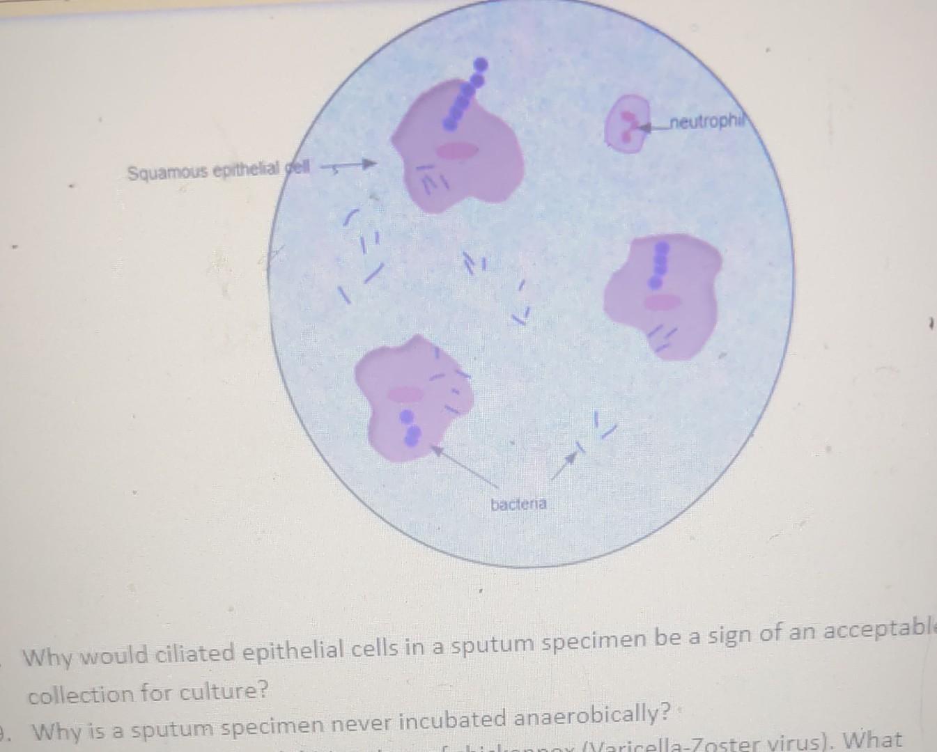 Solved Why would ciliated epithelial cells in a sputum | Chegg.com