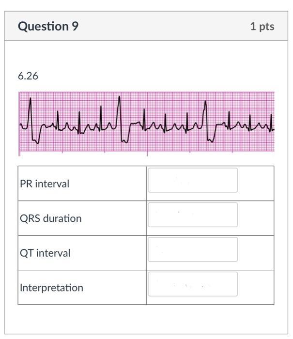 please help calculate the PR interval, QRS duration | Chegg.com