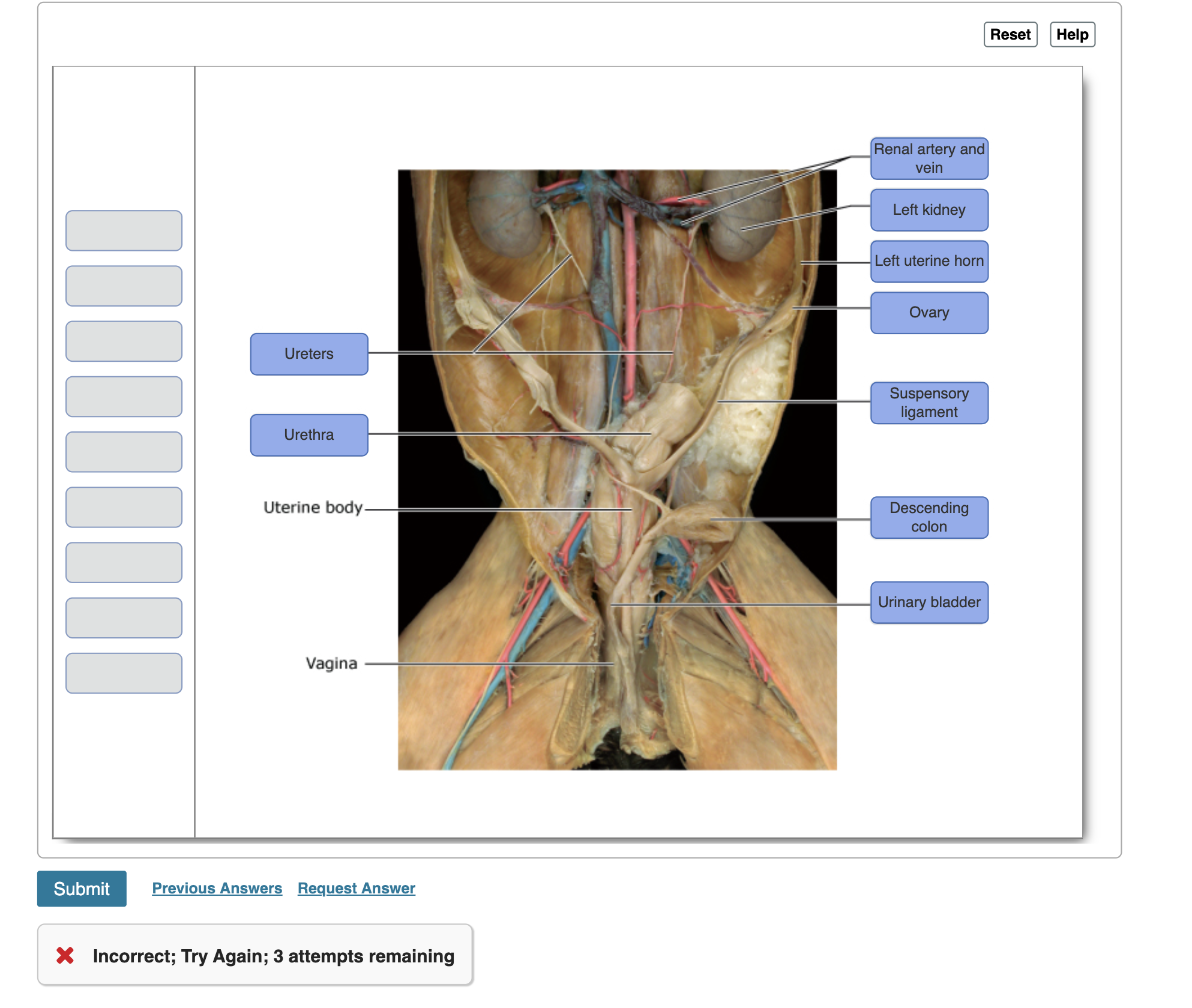 Solved Previous Answers Incorrect; Try Again; 3 ﻿attempts | Chegg.com