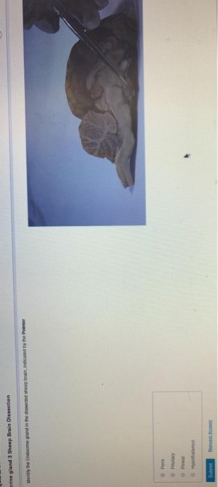 Solved An elevated ridge on the surface of the cerebrum is | Chegg.com