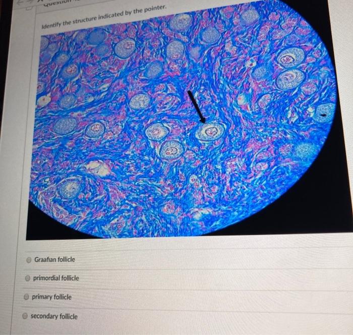 Solved чеэс Identify the structure indicated by the pointer. | Chegg.com