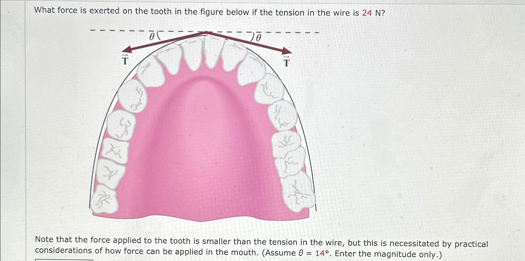 Solved What force is exerted on the tooth in the figure | Chegg.com
