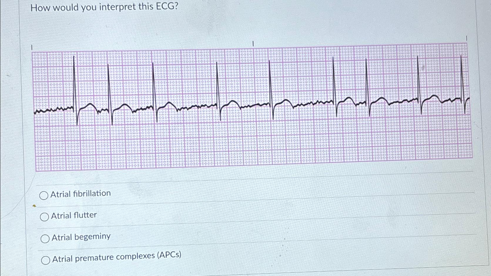 Solved How would you interpret this ECG?1Atrial | Chegg.com