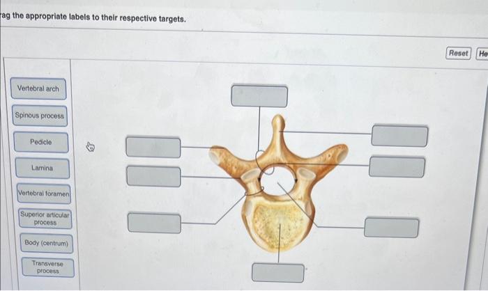 Solved Which part of a vertebra is known as the centrum? | Chegg.com