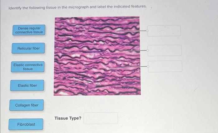 Solved Identify the following tissue in the micrograph and | Chegg.com
