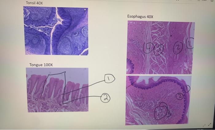 Solved Tonsil 40X Esophagus 40x D3 Tongue 100% DOX Liver | Chegg.com