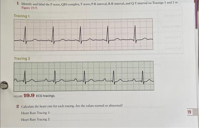 Solved 1 Identify and label the P wave, QRS complex, T wave, | Chegg.com