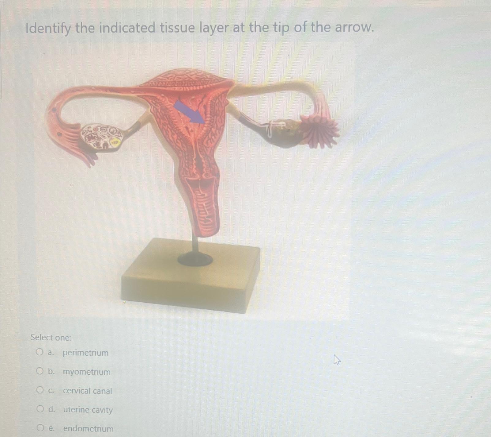 Identify the indicated tissue layer at the tip of the | Chegg.com