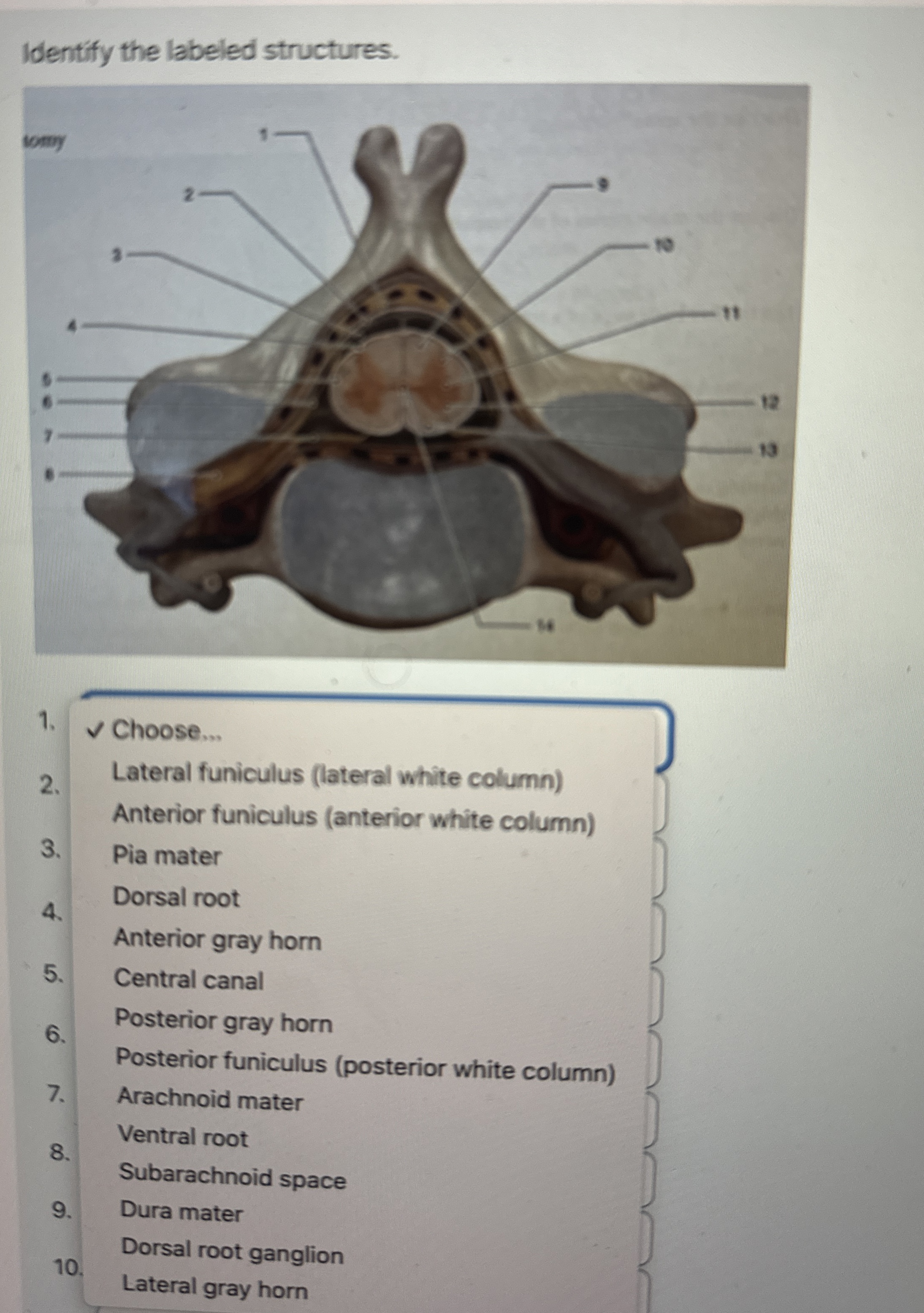 Solved Identify the labeled structures.Choose...Lateral | Chegg.com