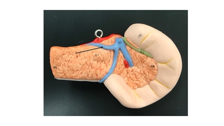 Solved Identify the vessel marked by the black arrow. | Chegg.com