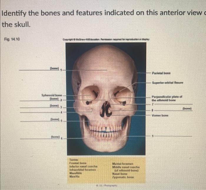 Solved Identify the bones and features indicated on this | Chegg.com